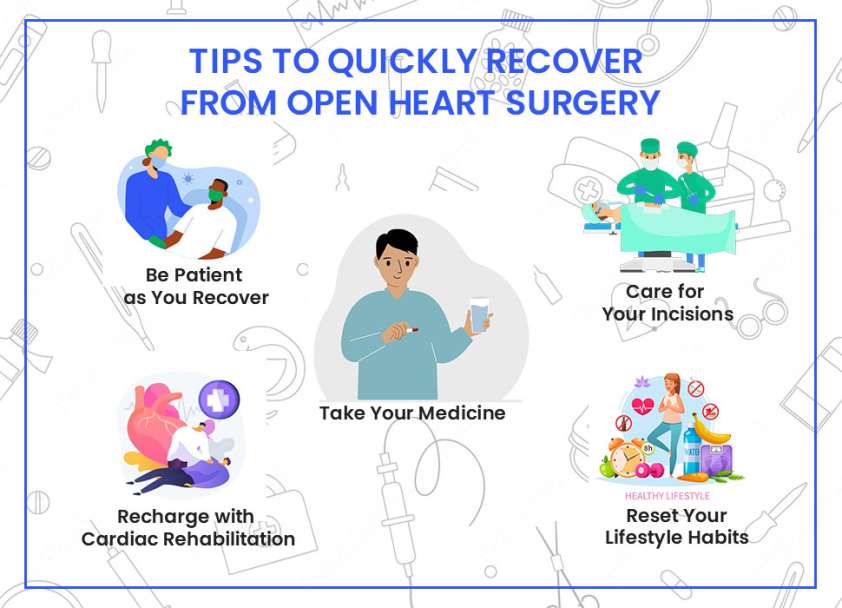 Navigating open heart surgery recovery and care | Urbanmatter