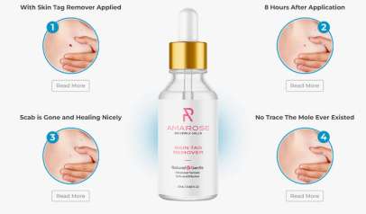 Amarose Skin Tag Remover Reviews - Dangerous Side Effects Risk or Safe ...